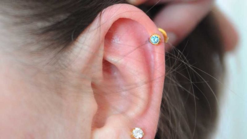 Piercing Bump vs. Keloid: How To Tell the Diferrence - BrazenDenver